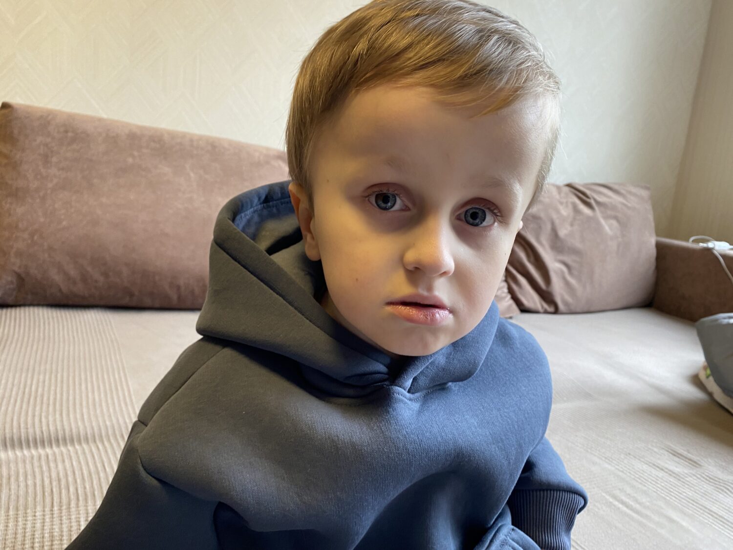 Витальев Демид. Опухоль у Демида занимала почти всё правое полушарие ...